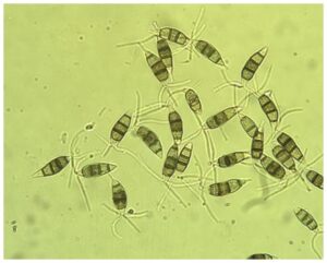 Neopestalotiopsis Crown, Leaf and Fruit Disease on Strawberry ...